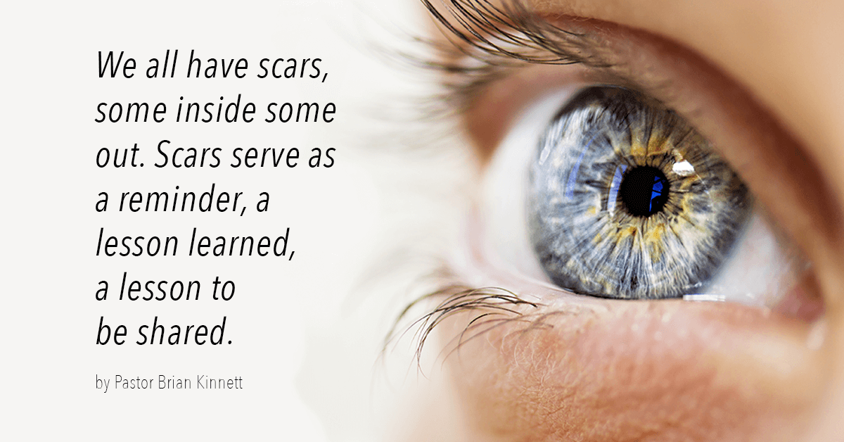 We All Have Scars Quote