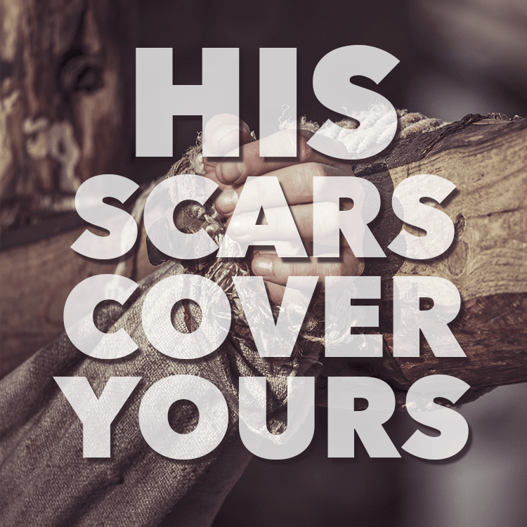 His scars, jesus scars, crucified, sacrifice, son of god, messiah